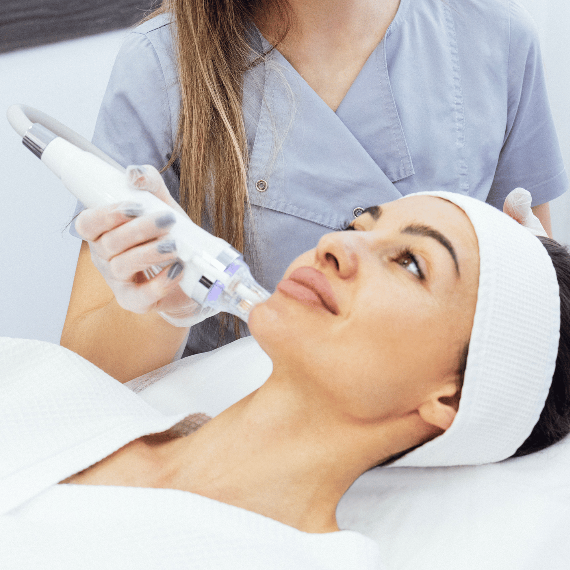 ADD-ON RF MICRONEEDLING ON NECK – Spirit Skin Care